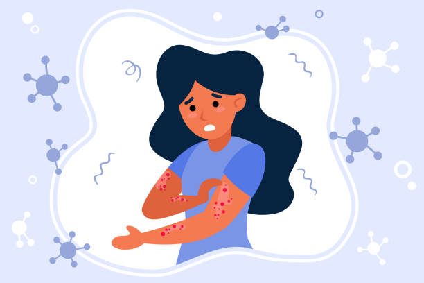 This Is What It's Like To Have Eczema And How I Manage It - Hera Health